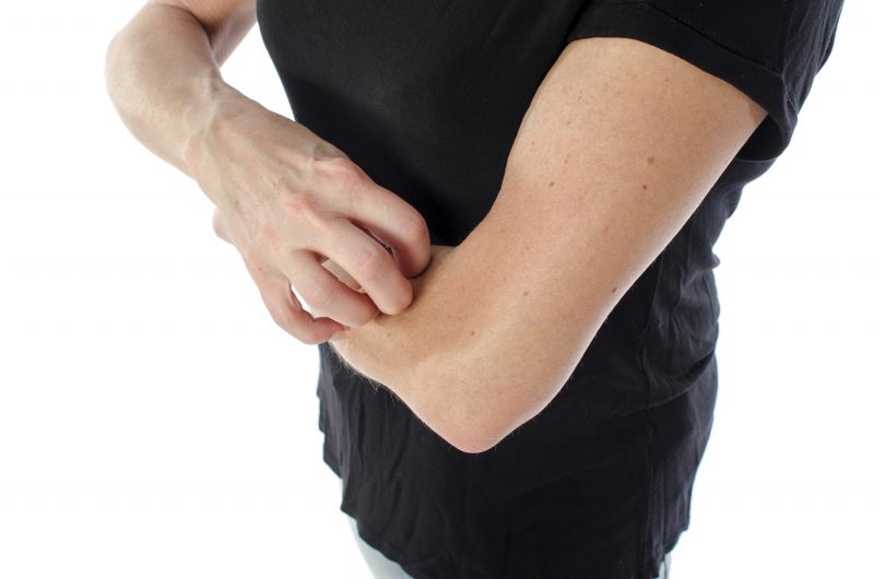 When To Seek Treatment For A Rash | Orlando | UCF Health